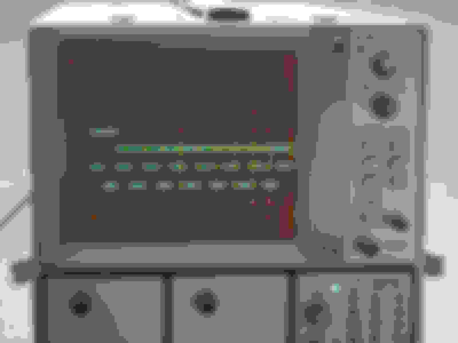 Opti-Spark Oscilloscope Pattern - Page 2 - CorvetteForum - Chevrolet ...