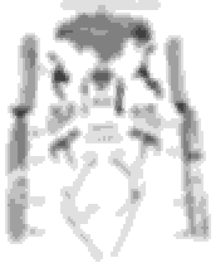 C2 Installing Ignition shielding on a 1966 Small Block - CorvetteForum ...